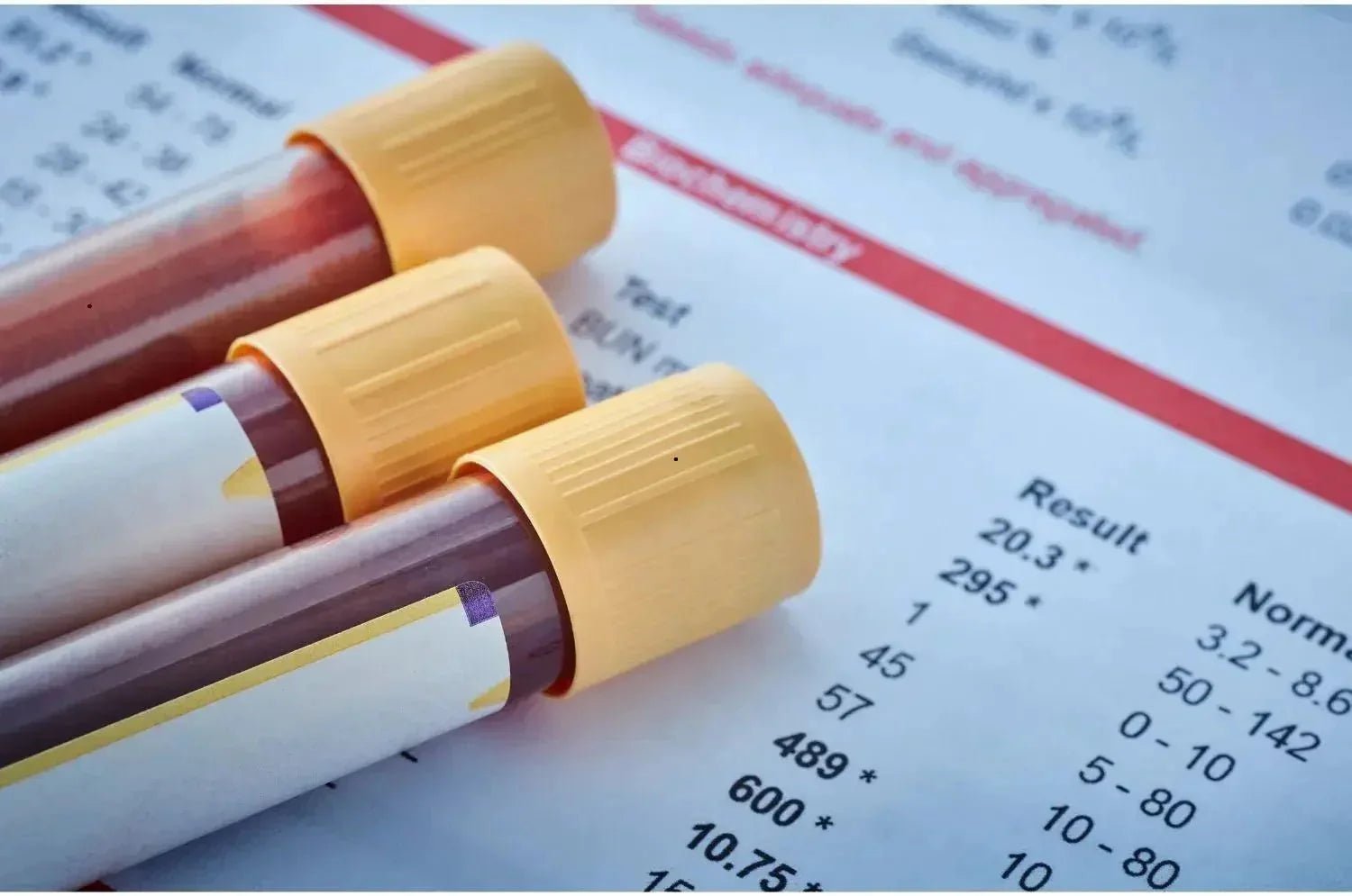 How Much Does a Private Blood Test Cost UK? Guide 2025 – The National ...